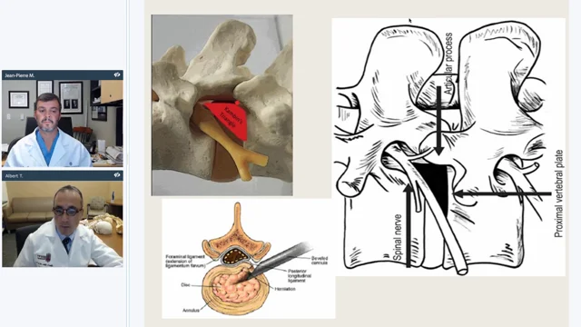 Lumbar Triangle Cadaver