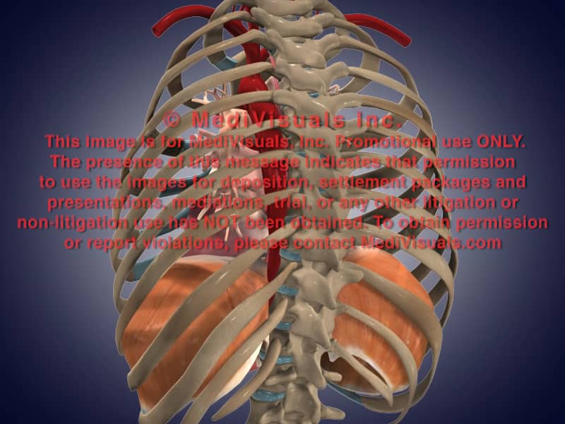 Cardiac Tamponade Animation - D28091-02XC on Vimeo