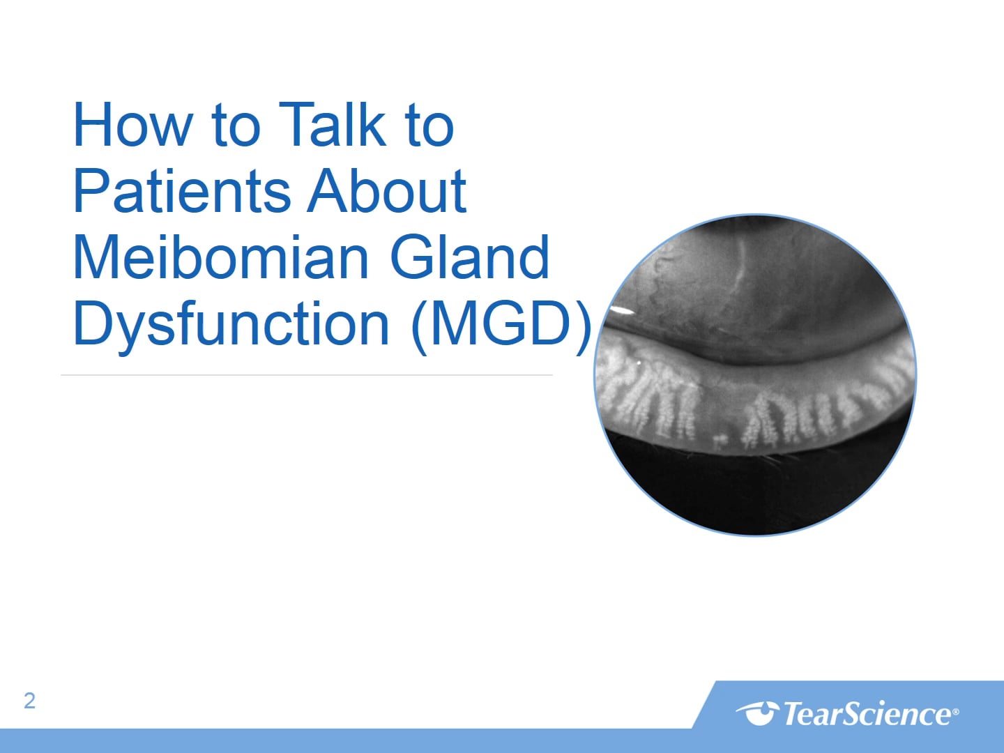 MGD and how to talk to patients about MGD on Vimeo