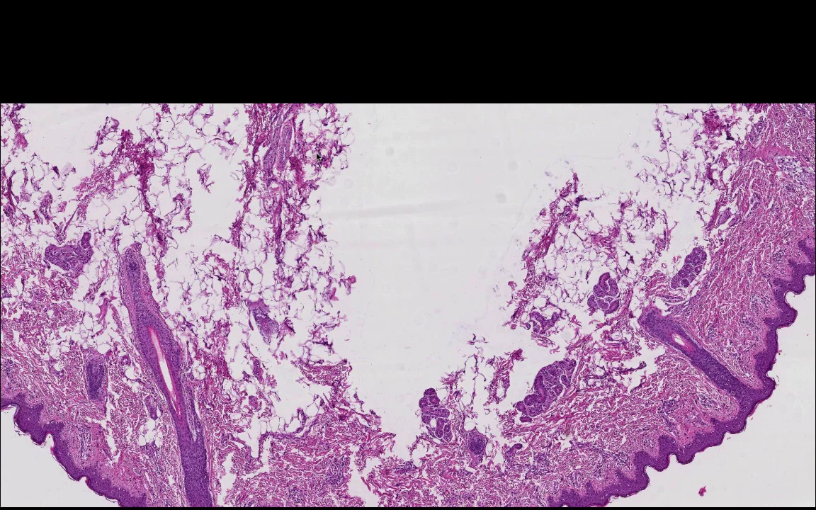 accessory tragus on Vimeo