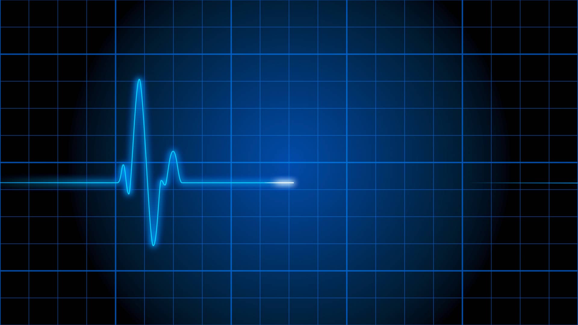 Electrocardiogram Stock Video - EKG 001 HD, 4K on Vimeo