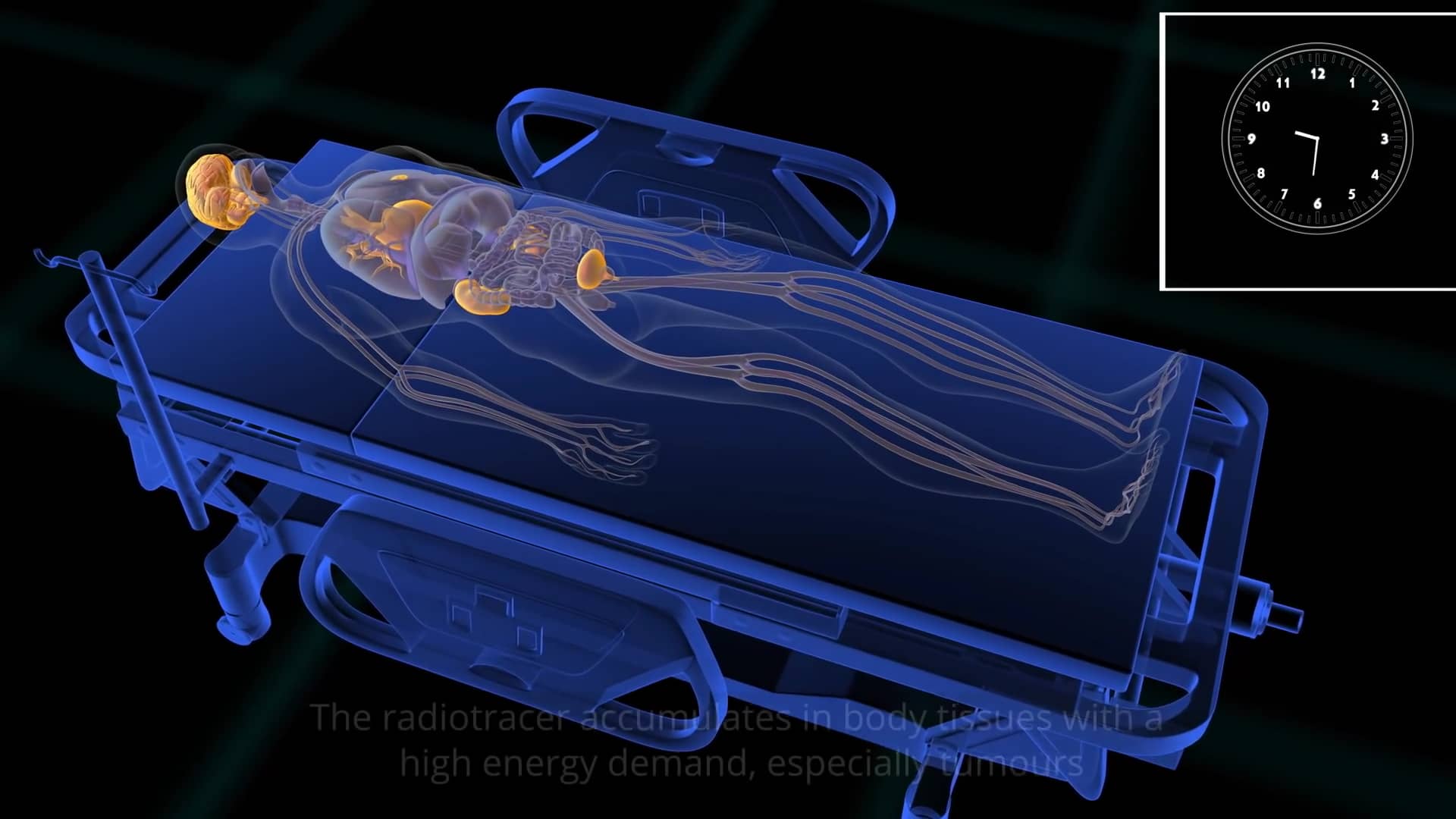 PET Scan animation on Vimeo