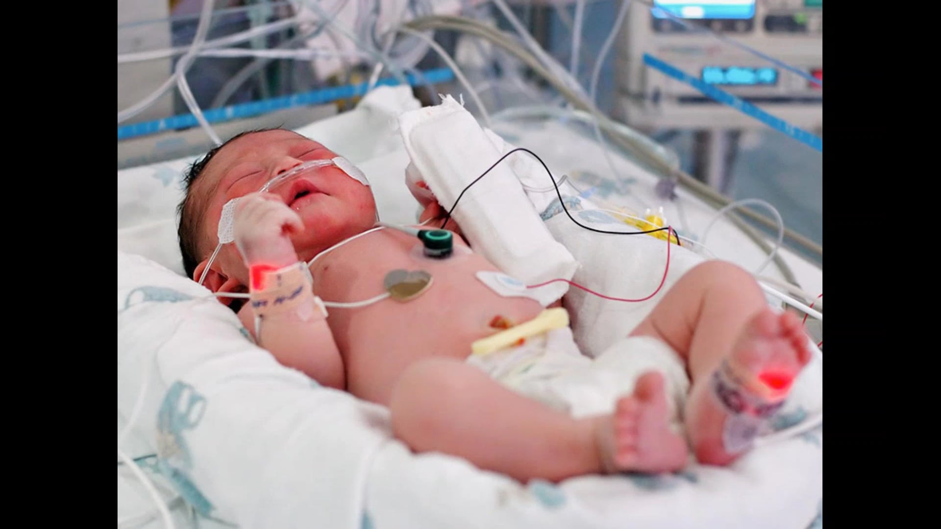 2017-01-12 14.02 Group Beta Strep - Screening and Treatment on Vimeo