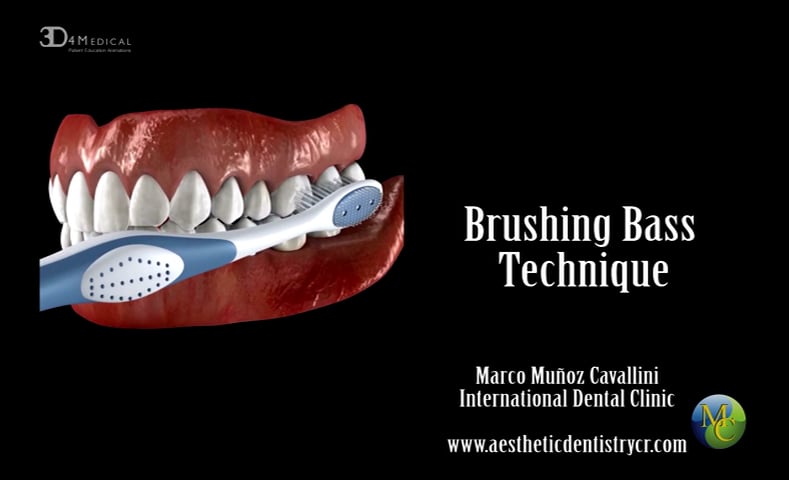 Brushing Bass Technique on Vimeo