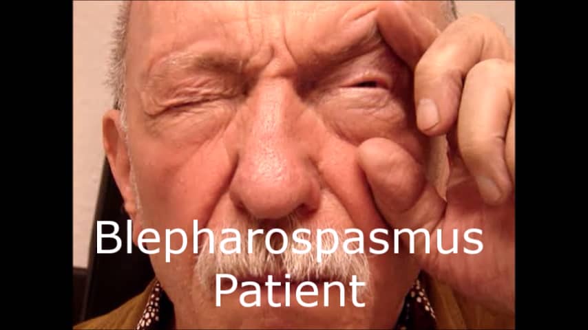 Blepharospasmus Patient on Vimeo