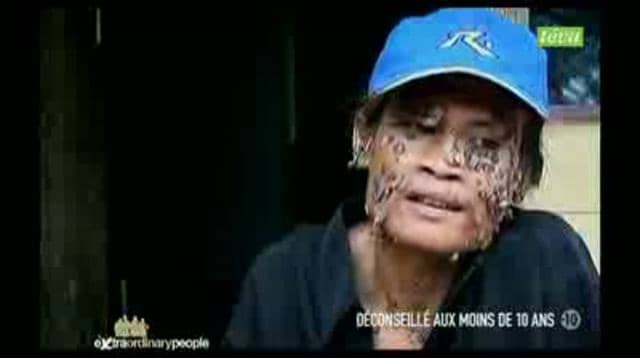 L'homme Arbre Part 1-4 on Vimeo