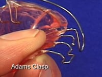 Adam's Dental Clasps, Dental Appliance Clasps | SML | Southwest