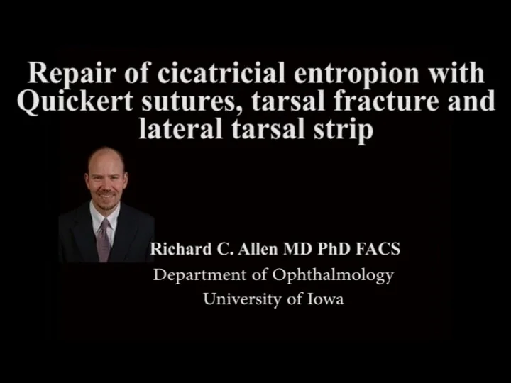 Repair of cicatricial entropion with Quickert sutures, tarsal fracture ...