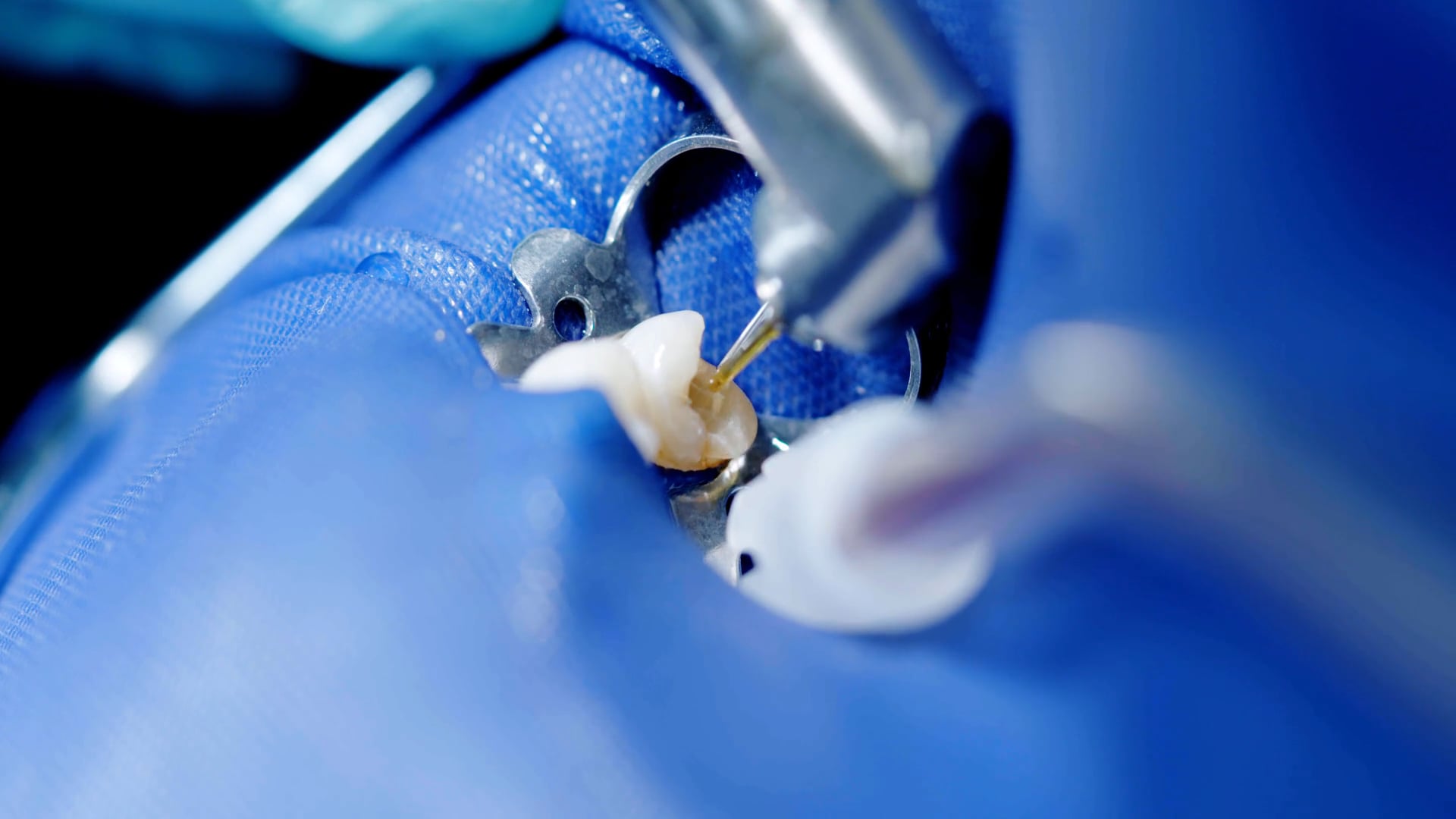 HS_Praxis-DR KELSCH - PIPS on Vimeo