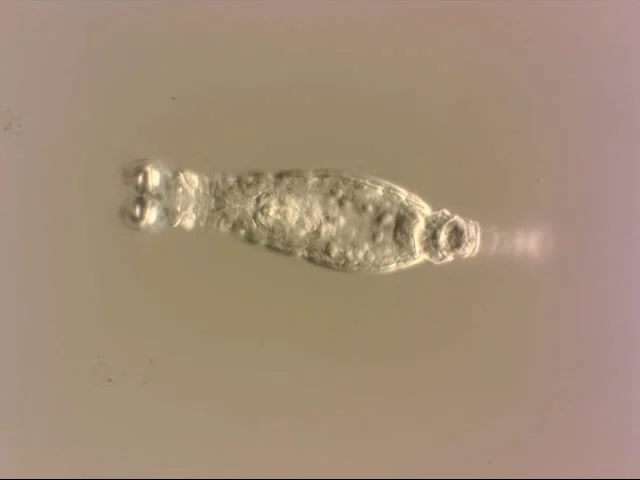 Rotifer, multicellular metazoa, you can identify the corona (cilia ...