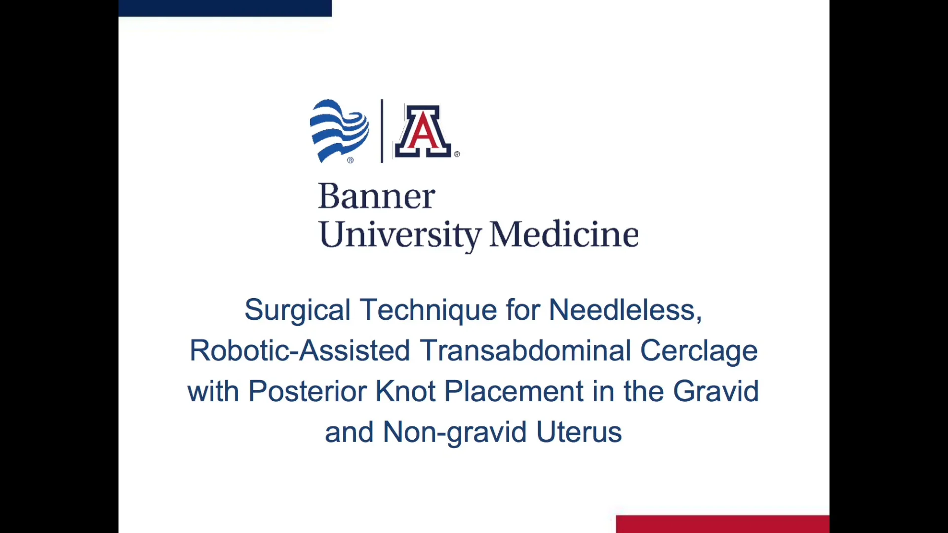 Video Cafe 30 SURGICAL TECHNIQUE FOR NEEDLELESS ROBOTIC-ASSISTED ...