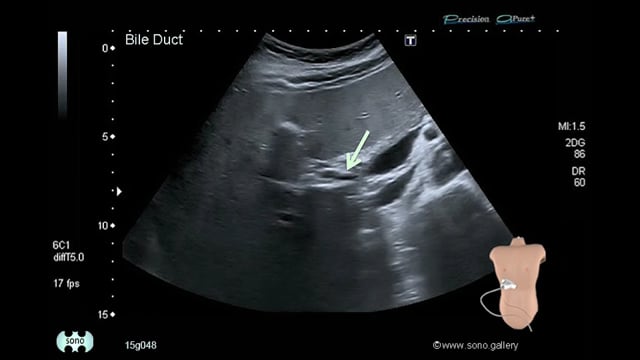 Normal Appendix - SONO.GALLERY