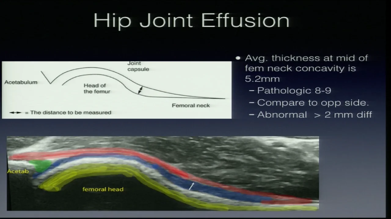 MSK Ultrasound of the Hip, Pelvis, and Thigh
