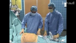 Laparoscopic repair of multiple primary defect of linea alba with ...