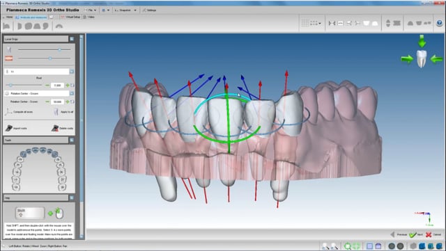 Planmeca Romexis 3D Ortho Studio on Vimeo