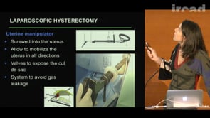 Total Laparoscopic Hysterectomy (TLH) | WebSurg, the online university ...
