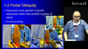 Arthroscopic radial styloidectomy | WebSurg, the online university of IRCAD