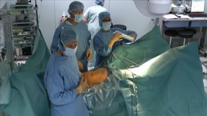 Laparoscopic surgical sacral colpopexy for genitourinary prolapse after ...