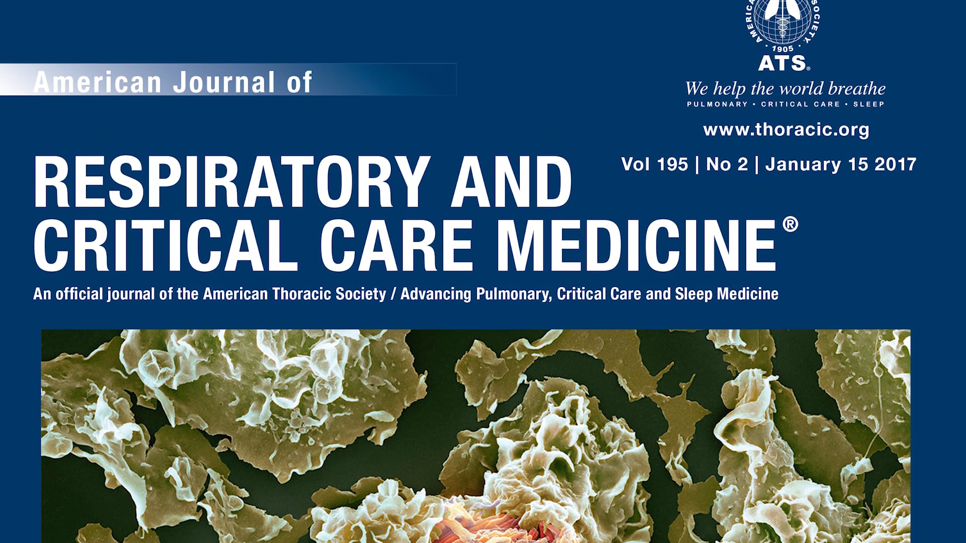 ATS AJRCCM Journal Promo on Vimeo