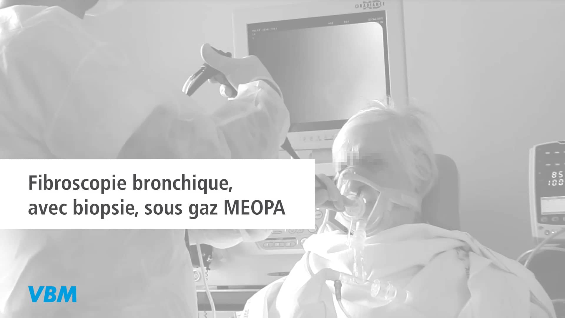 Fibroscopie bronchique, avec biopsie, sous gaz MEOPA on Vimeo