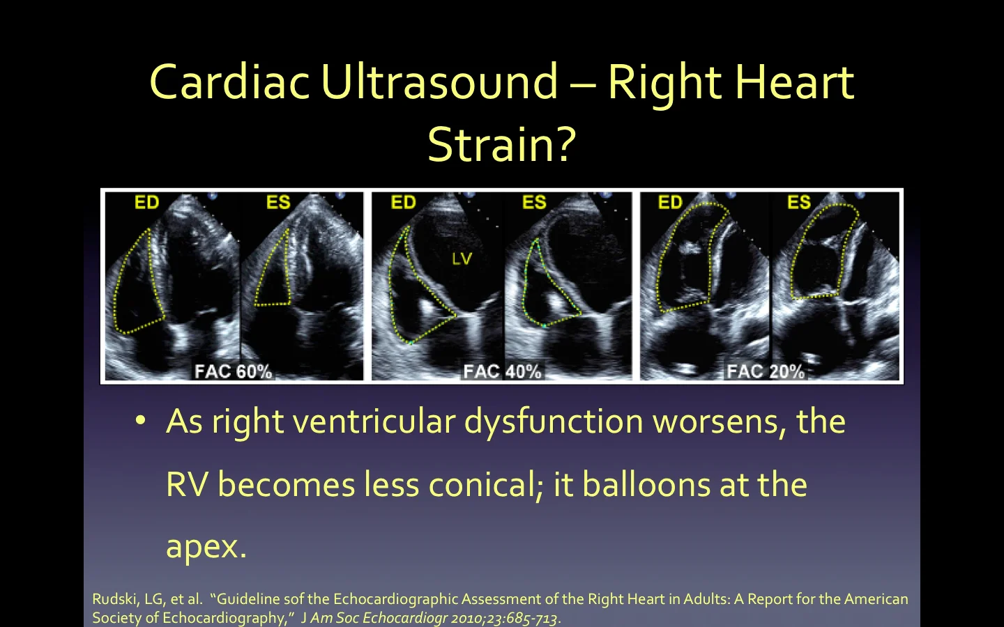 Resuscitation Ultrasound - the RUSH exam