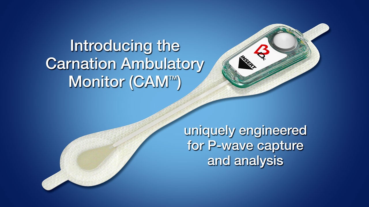 Carnation Ambulatory Monitor on Vimeo