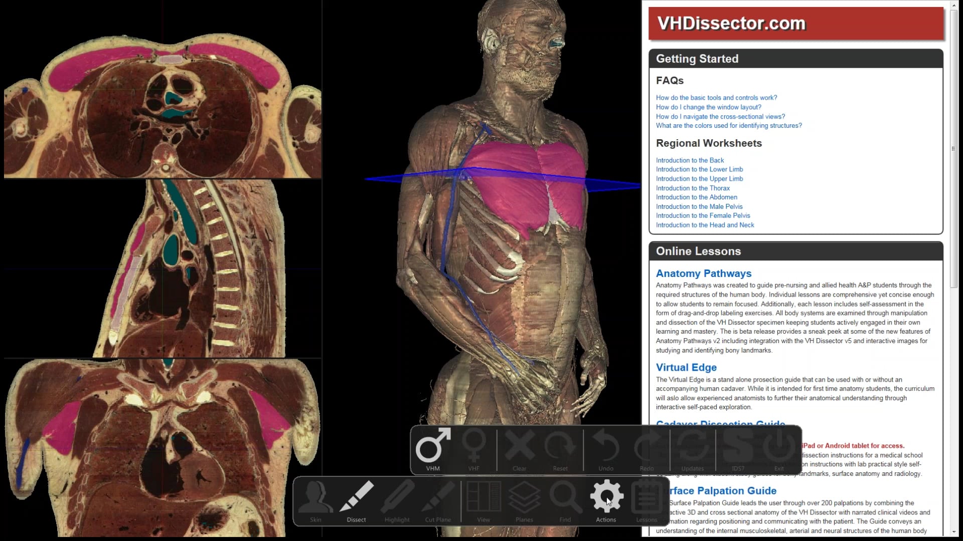 How To Demonstrate the VH Dissector Table on Vimeo