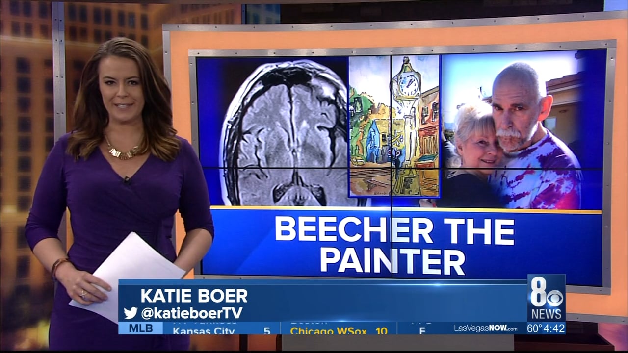 04/2017 - Katie Boer Medical/Feature Reporting - "Beecher The Painter ...