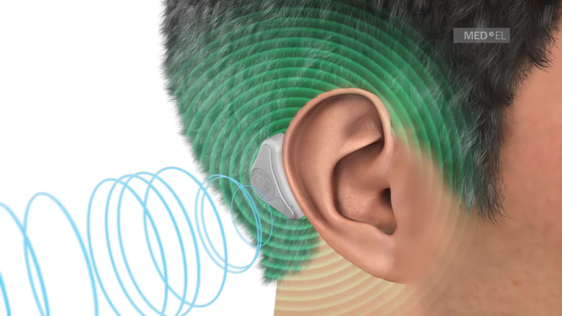 How ADHEAR works on Vimeo