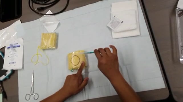 Vessel loop drainage on Vimeo