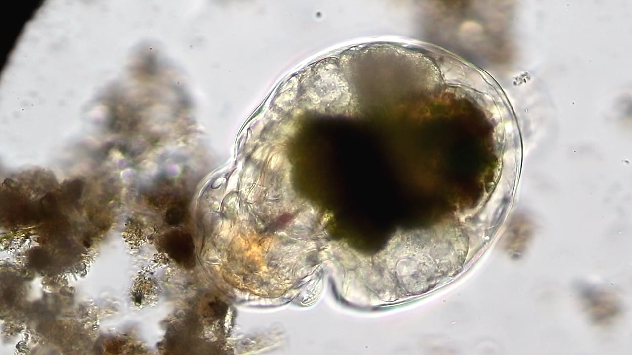 Thriving Pond Life Under a Microscope on Vimeo