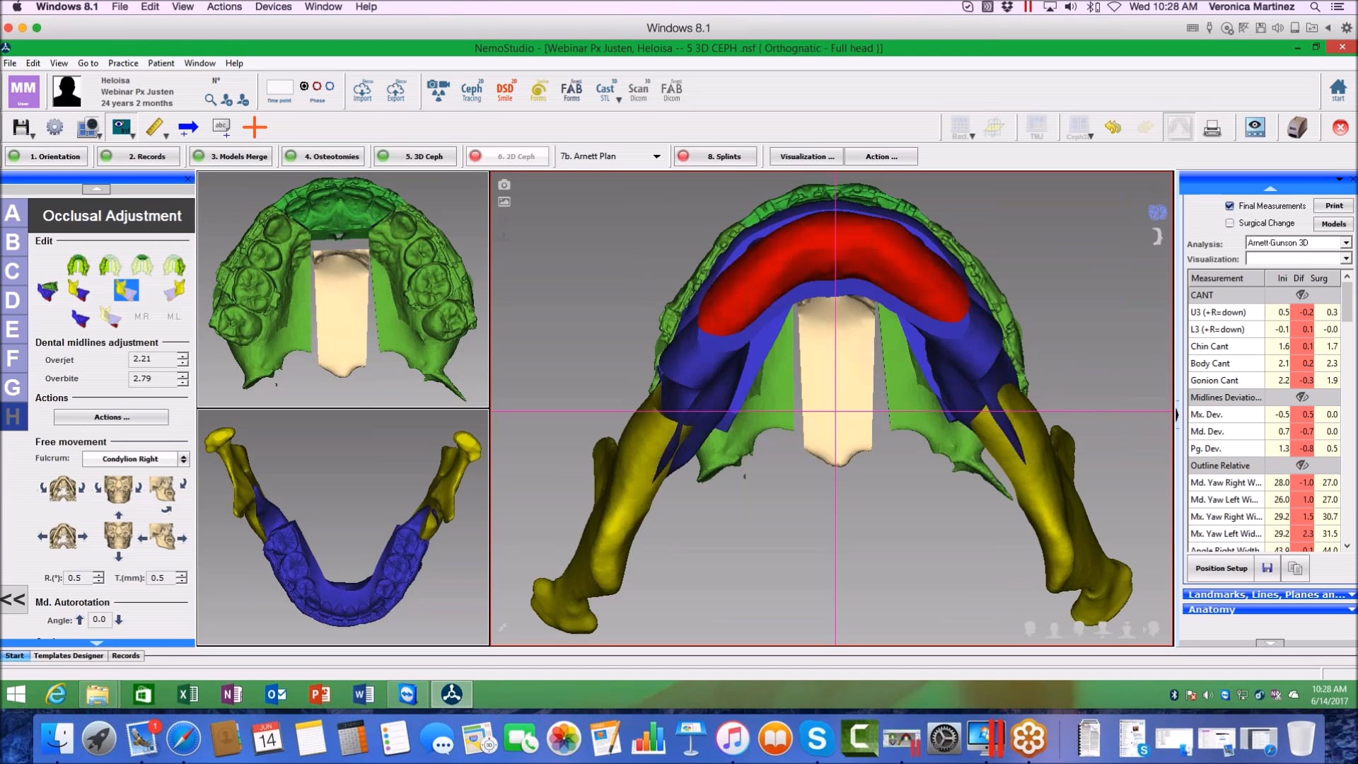 Webinar NemoFAB. Treatment Plan for the Class II Patients on Vimeo