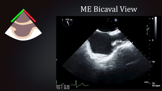 Tiger Plakat Brutal bicaval view tee Einwand Entlassen Quagga