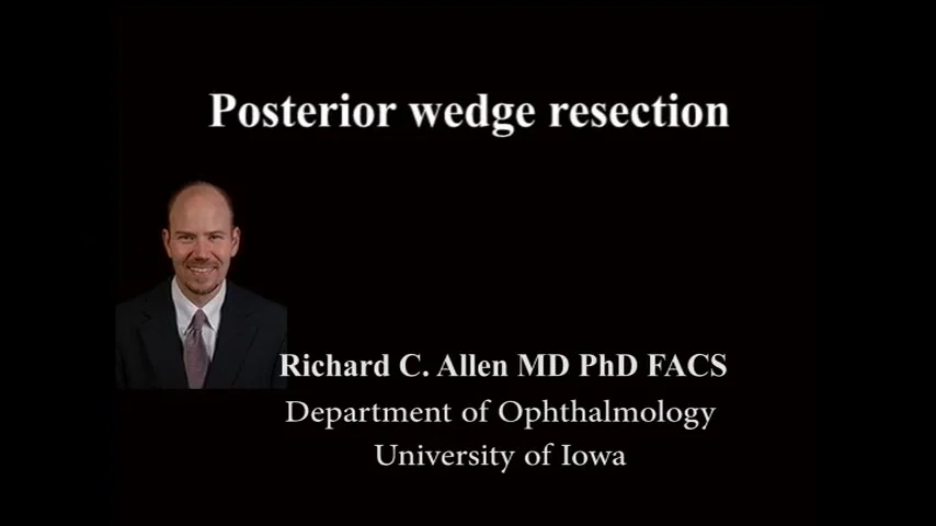 Posterior wedge resection