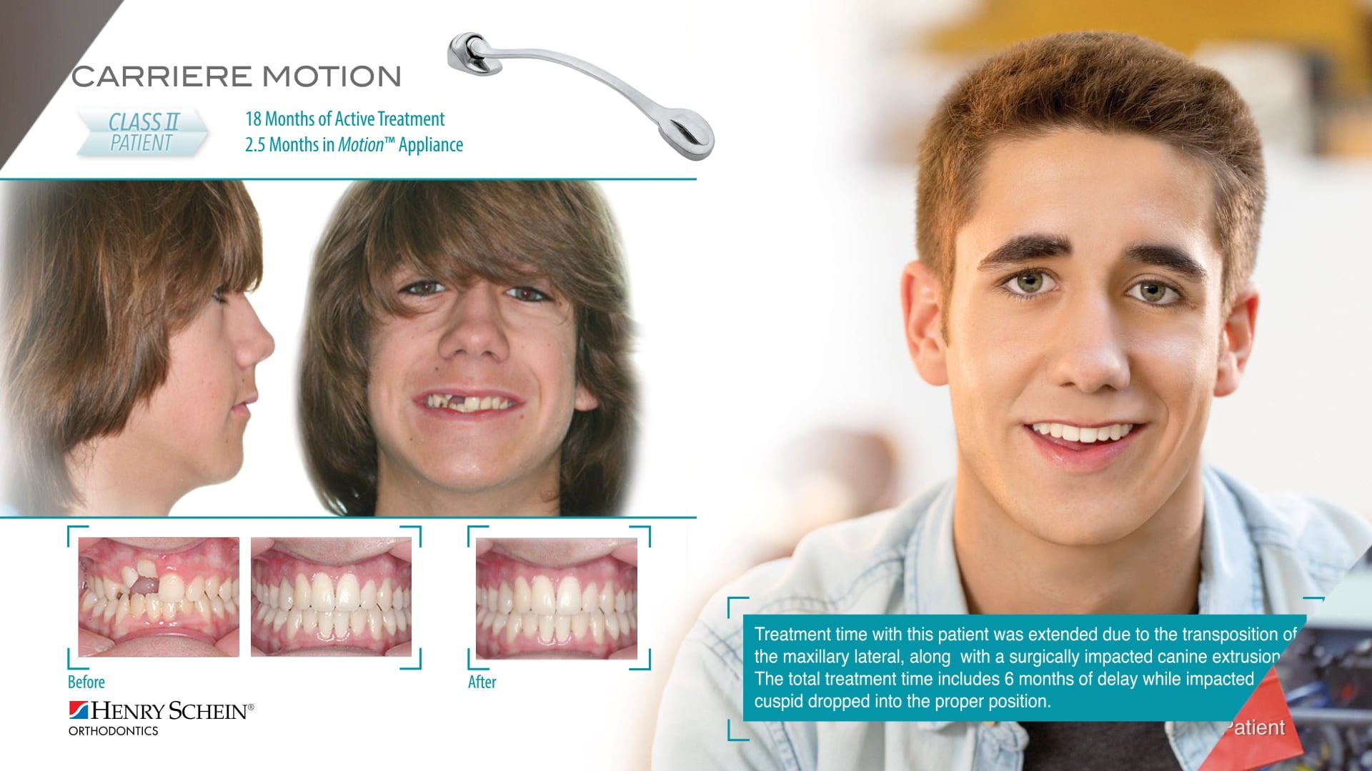 Carriere Motion（カリエールモーション）プロモーション動画 | Doctorbook academy (ドクターブックアカデミー)