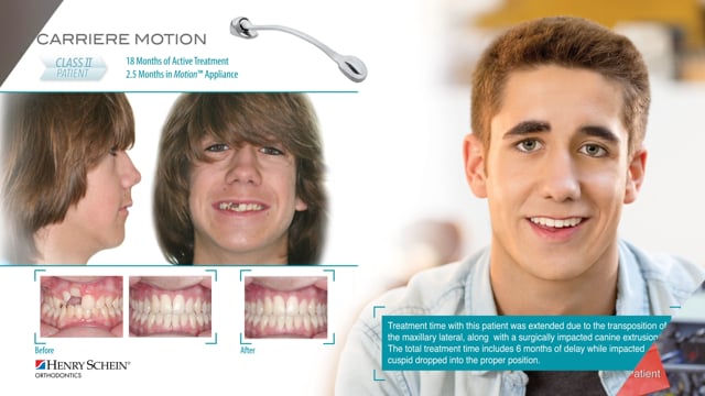 Carriere Motion（カリエールモーション）プロモーション動画 | Doctorbook academy (ドクターブックアカデミー)