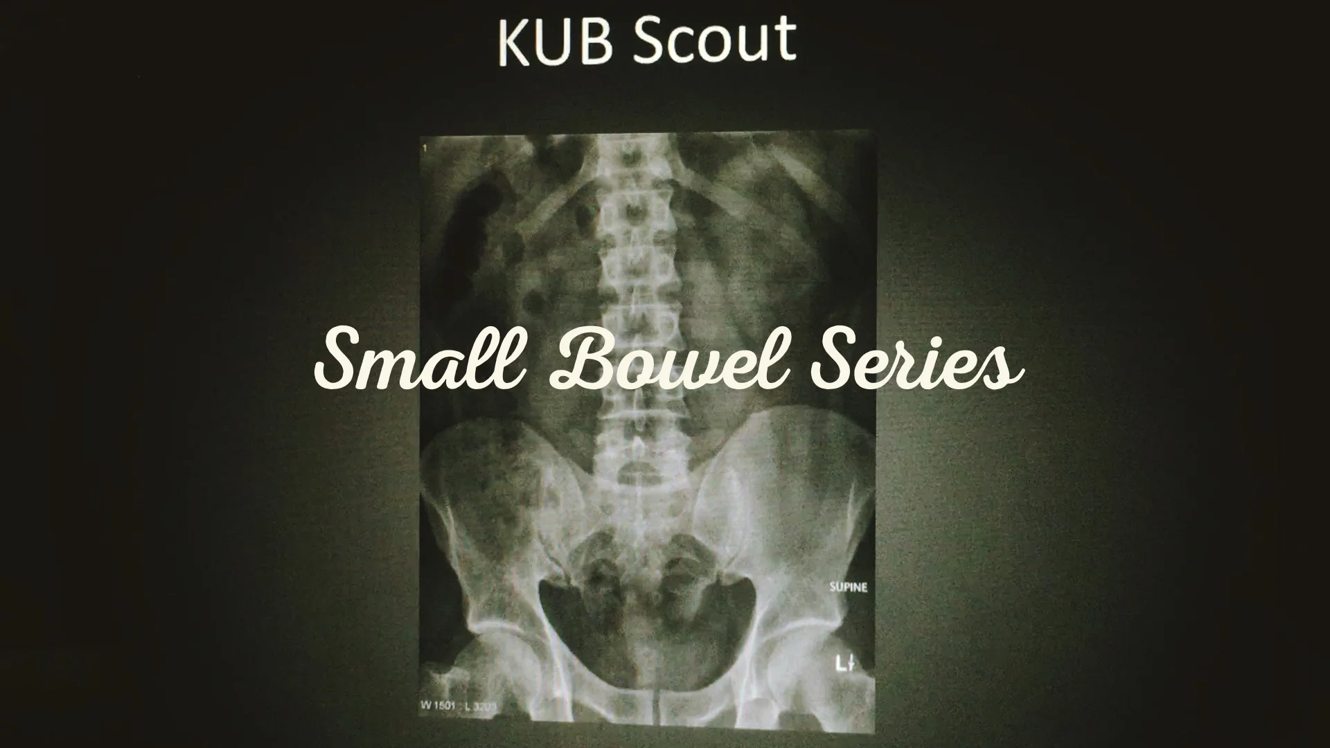 Small Bowel Series on Vimeo