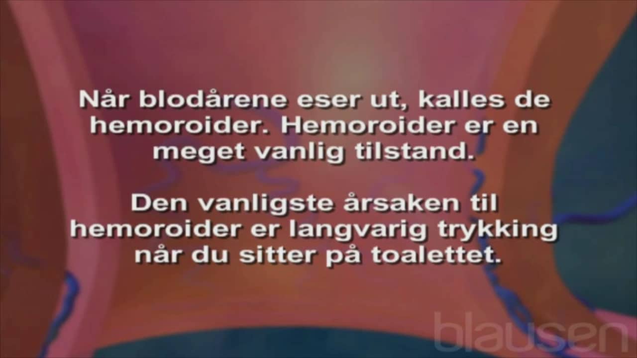 Hemoroider on Vimeo