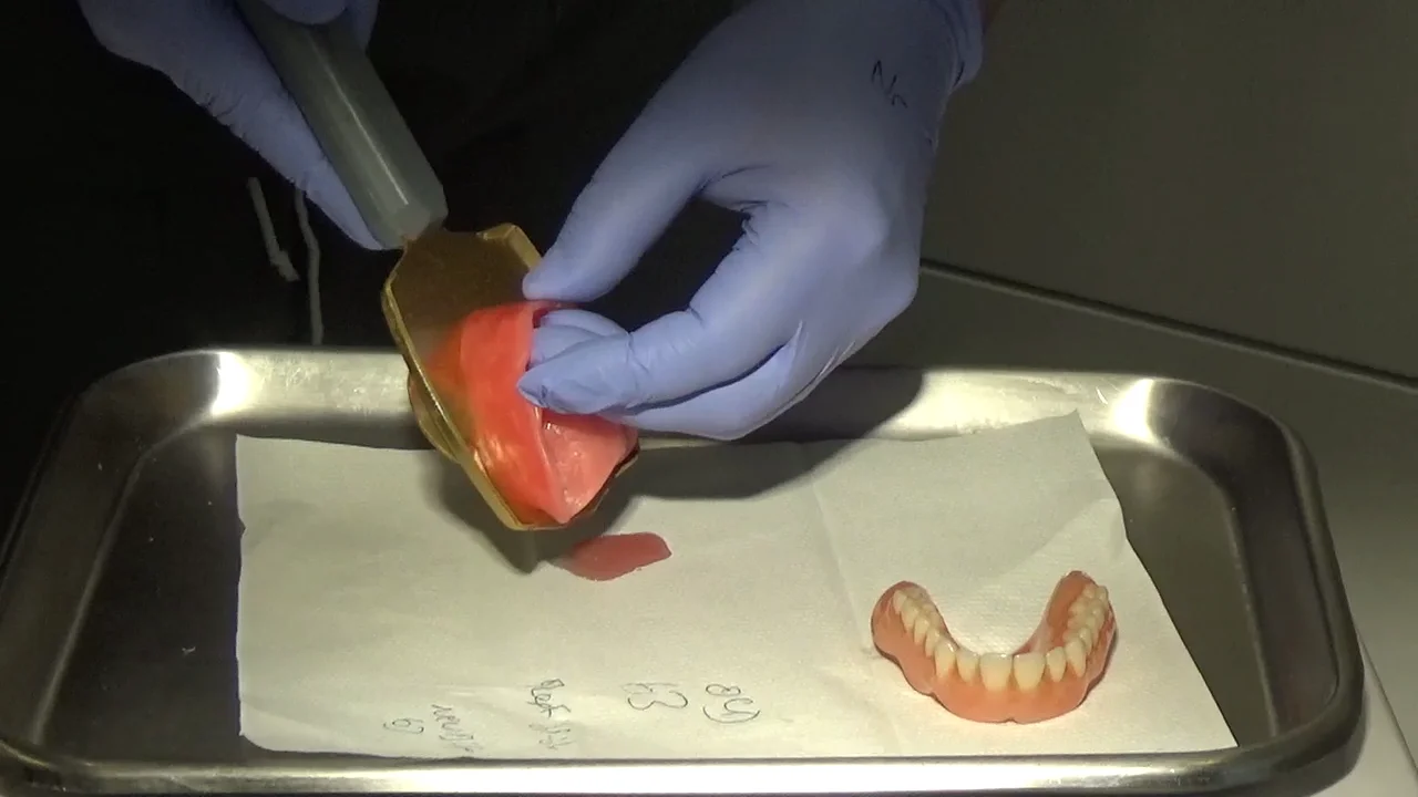 Denture Excellence: Adjusting the bite block for the agar tragus on Vimeo