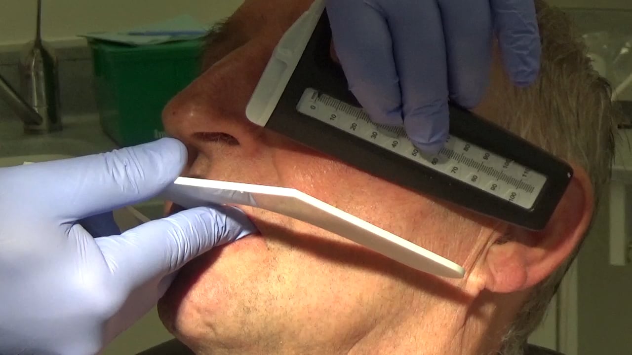 Denture Excellence: Checking the agar tragus line on Vimeo