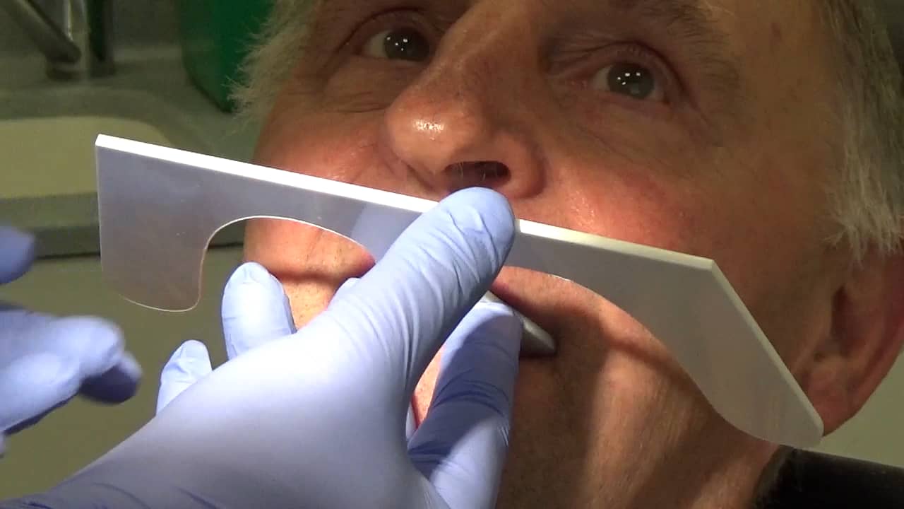 Denture Excellence: Foxs plane on Vimeo