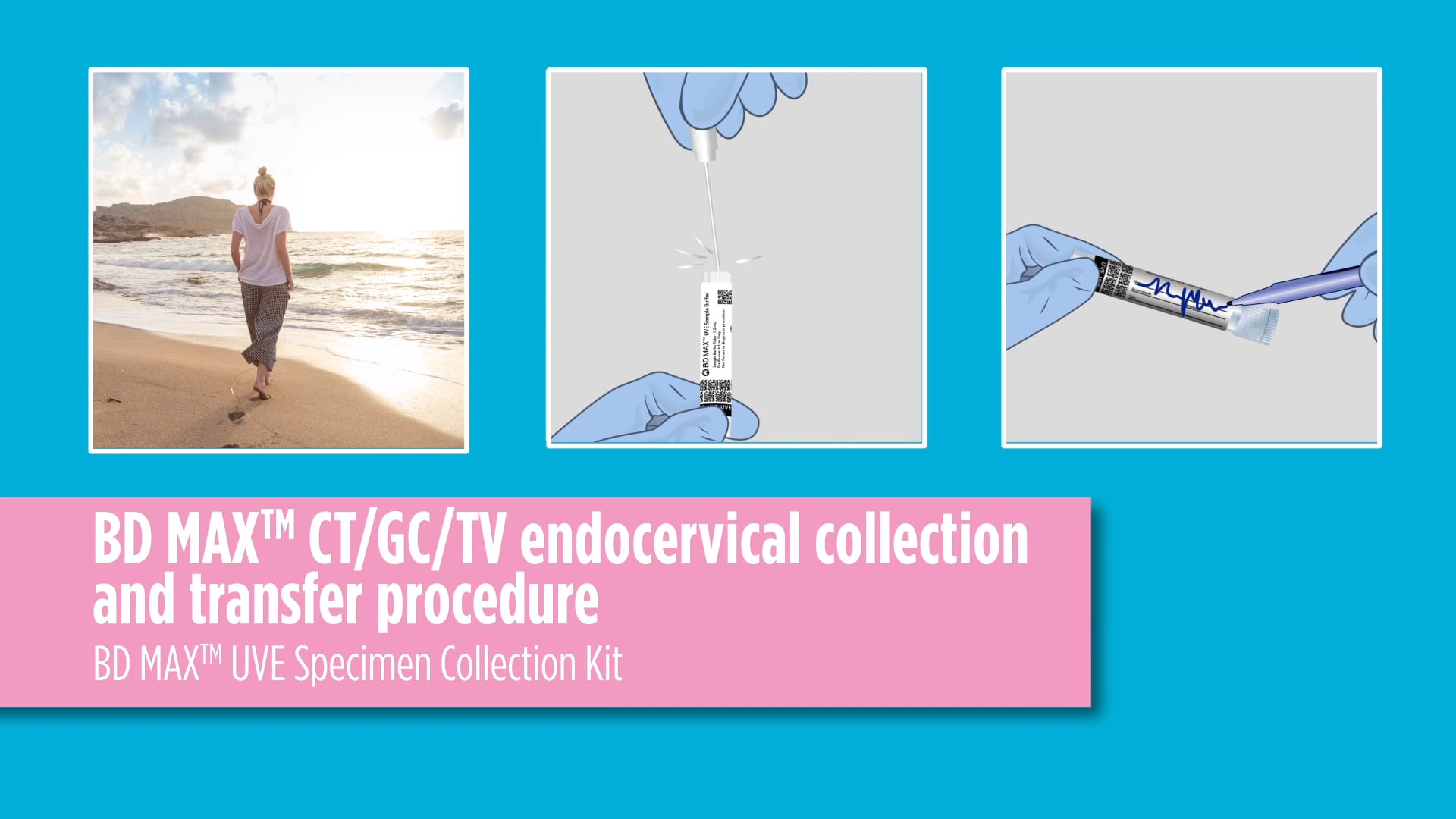 CT/GC/TV Endocervical Collection and Transfer Procedure on Vimeo