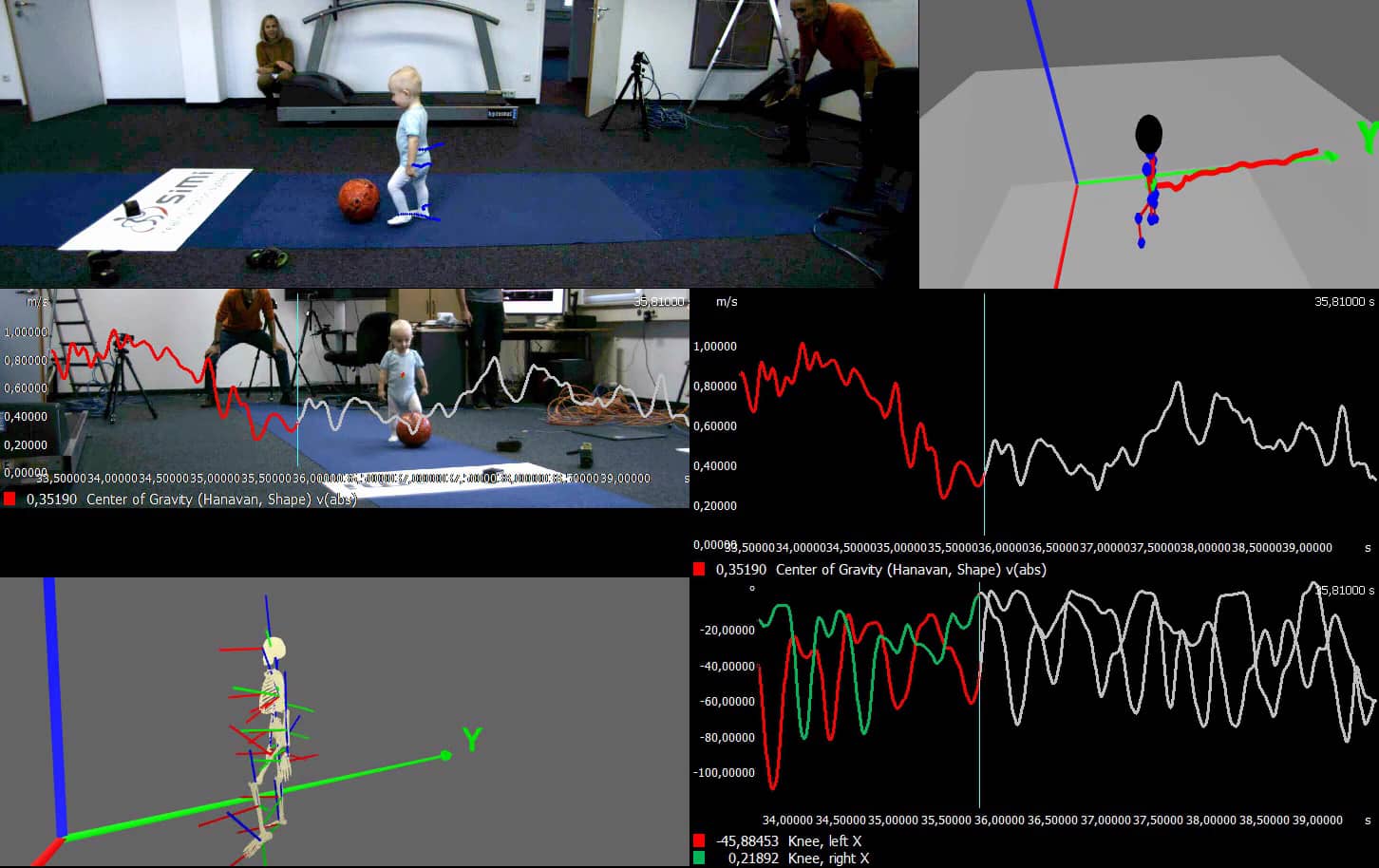 Toddler gait analysis - markerless motion analysis on Vimeo