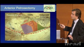 Anterior petrosectomy technique | WebSurg, the online university of IRCAD