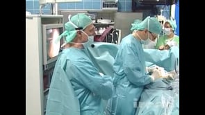 Video-assisted left thyroid lobectomy | WebSurg, the online university ...