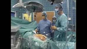 Laparoscopic cholecystectomy: a gold standard case for the dissection ...