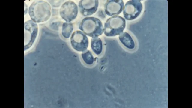 Yeast Cells Under Microscope