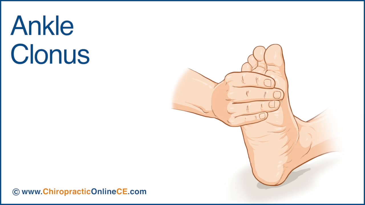 US-Ankle Clonus Video-2017-Vimeo on Vimeo