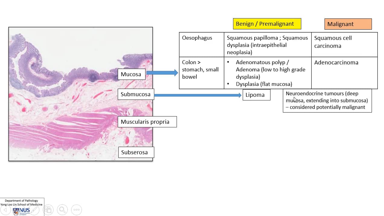 GI Tumours Crash Course on Vimeo