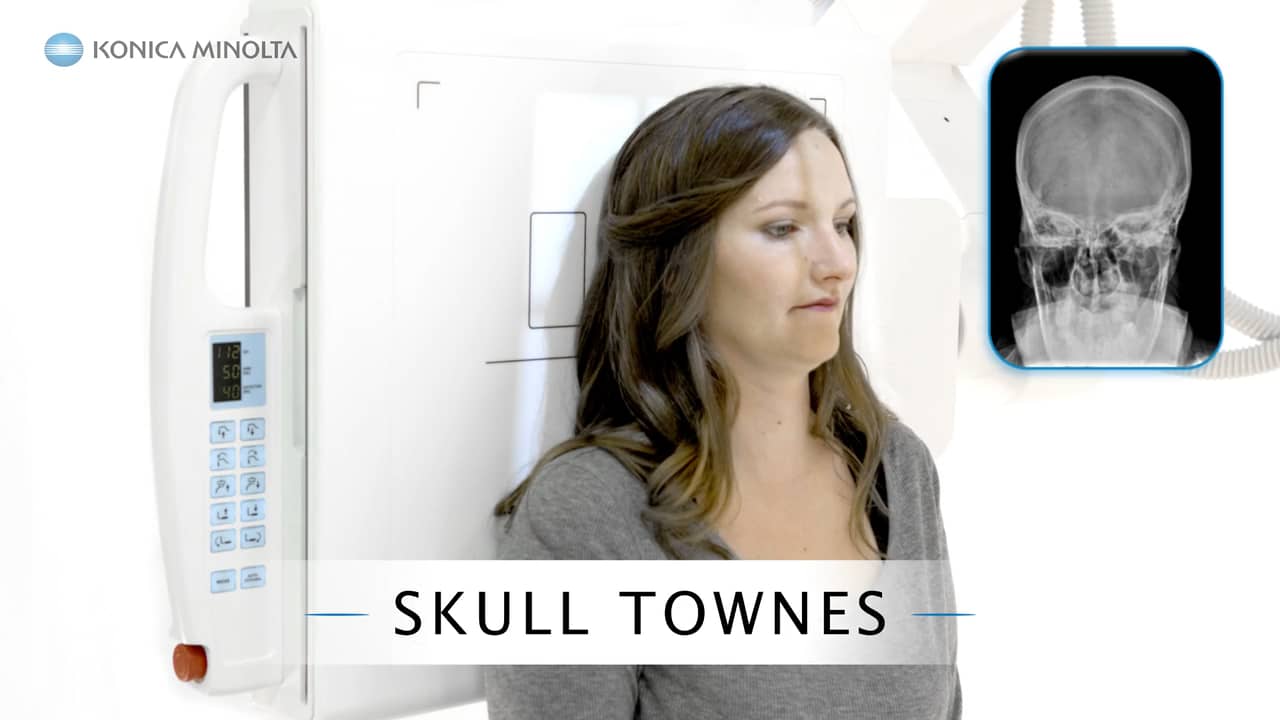 KDR™ POSITIONING GUIDE on Vimeo